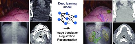 Overview Of Image Synthesis 2d3d Image Reconstruction And Enhancement Download Scientific