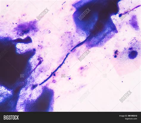 Pseudohyphae On Microscope