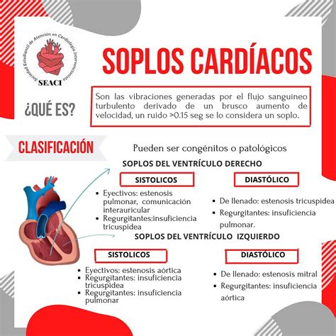 Seaci🫀 Los Soplos Cardíacos Son Vibraciones Generadas Por El Flujo