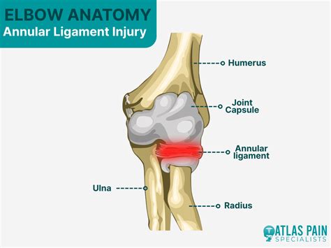 Annular Ligament Injury Symptoms Atlas Pain Specialists