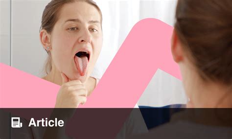 Tongue Hyperpigmentation With Peginterferon α 2b Therapy In Hepatitis B