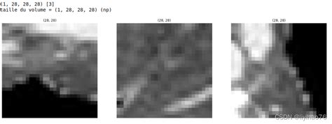 Pytorch Resnet3d预训练网络 Medmnist 3d医学数据分类medmnist数据集 Csdn博客 Pytorch Resnet3d预训练网络 Medmnist 3d医学数据分类medmnist数据集 Csdn博客