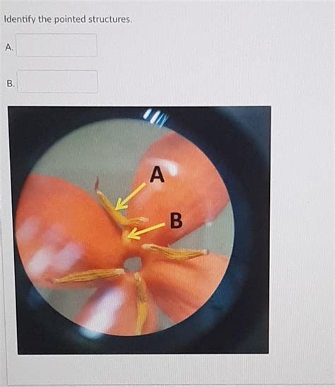 Solved Identify The Pointed Structures A B A B Chegg