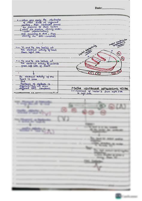 SOLUTION Ecg Qrs Complex In Chest Leads By Dr Najeeb Studypool