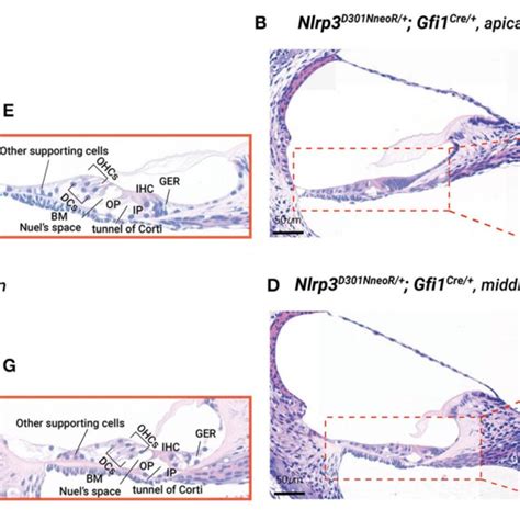 Chronological Evaluation Of Cochlear Morphology In Nlrp3 D301nneor Download Scientific