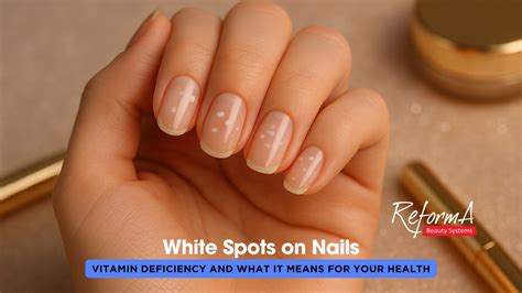 White Spots On Nails Vitamin Deficiency And What It Means For Your Hea