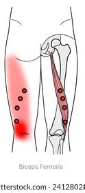 Myofascial Trigger Point Hamstrings Biceps Femoris Stock Illustration Shutterstock