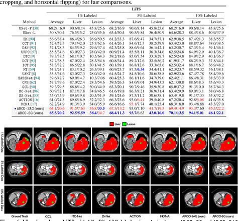 Table 5 From Rethinking Semi Supervised Medical Image Segmentation A