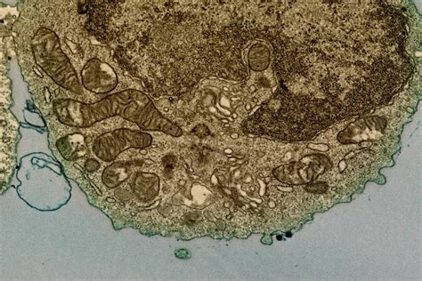 37 Facts About Rabies