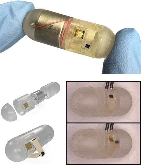 microtech ventures on linkedin medical mems ingestible capsule will