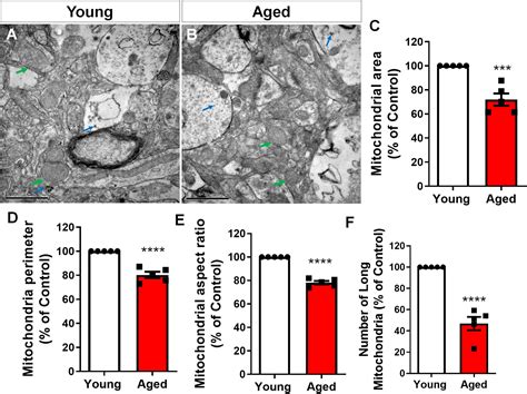 Frontiers Aging Promotes An Increase In Mitochondrial Fragmentation In Astrocytes