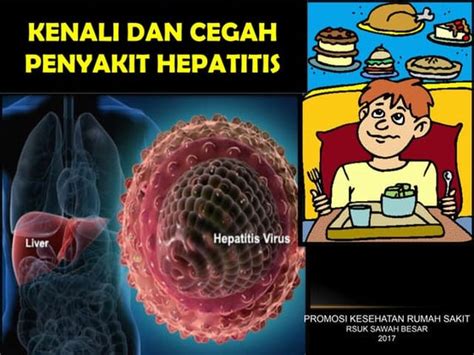 Hepatitis Hepatitis Hepatitis Hepatitis Pptx