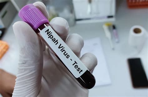 Rumah Sakit Dengan Pelayanan Berkualitas Siloam Hospitals