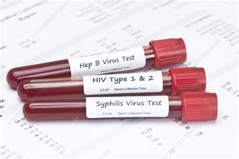 STD Tests Stock Image F035 8874 Science Photo Library