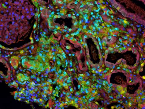 Multiplex Imaging Center Arkana Laboratories