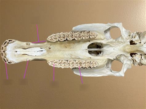 Upper Dental Arcade Diagram Quizlet