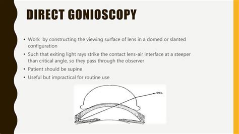 Gonioscopy Pptx