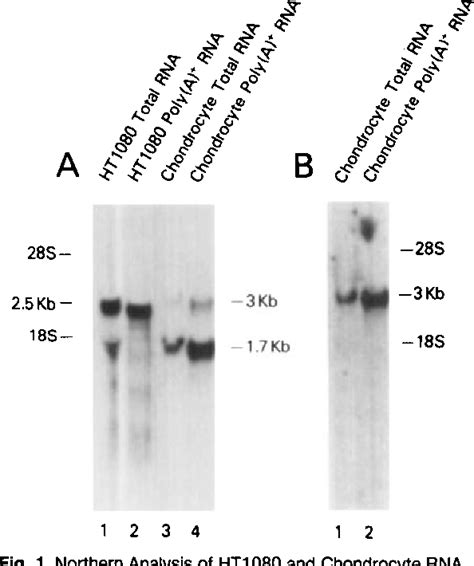 Figure 1 From Complementary Deoxyribonucleic Acid Cloning Of A Novel Transforming Growth Factor