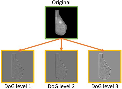 Difference Of Gaussians As Input To The Model Download Scientific