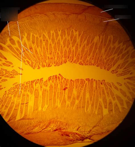 Duodenum Flashcard Quizlet