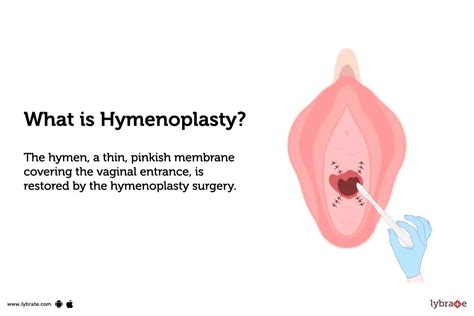 Hymen Reconstruction
