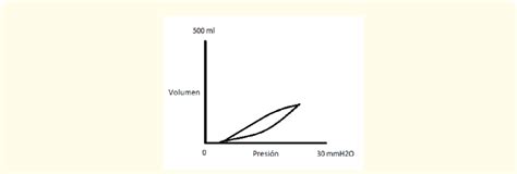 Pressure Volume Loop In Which A Pulmonary Pattern Of Restrictive Type Download Scientific