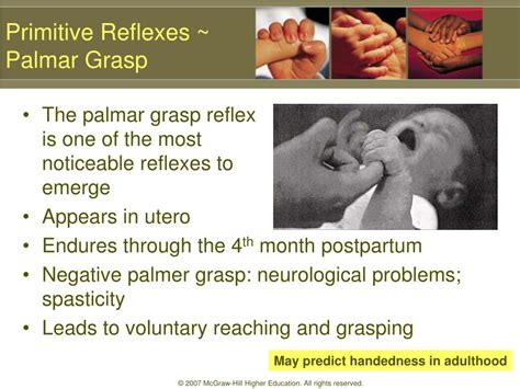 Ppt Infant Reflexes And Stereotypies Powerpoint Presentation Free