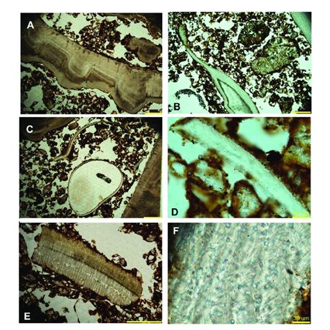 A Scan Of The Resin Impregnated Section Of Shell Midden Used For Tima Download Scientific