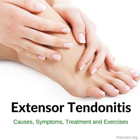 How To Wrap Foot For Extensor Tendonitis At Darlene Flores Blog