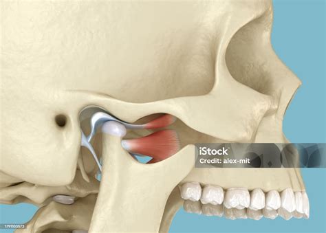 Anterior Tmj Dislocation Temporomandibular Joint Dislocation Lfmy