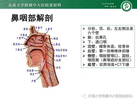 【ppt】鼻咽癌影像及分期 影像ppt