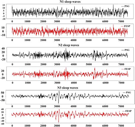 Comparative Analysis Of Sleep Parameters And Structures Derived From
