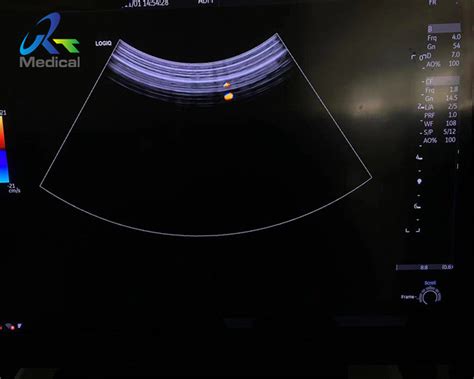 Ge C1 6 D Convex Array Ultrasound Probe Transducer Maintenance Strain