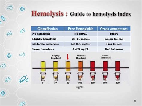 Interferences In Clinical Chemistry Analysis