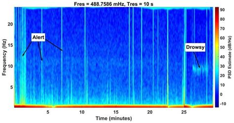 Eeg Spectrogram With Psd Estimates Showing Alert And Drowsy Brain Download Scientific Diagram