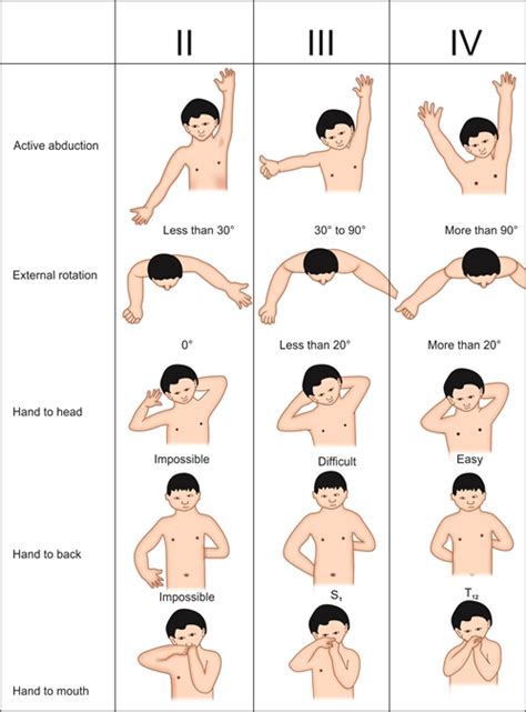 Erbs Palsy Shoulder Exercises