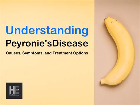 Understanding Peyronies Disease Causes Symptoms And Treatment