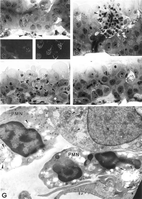 Polymorphonuclear Leukocyte Pmnl Chemotaxis Is Triggered To