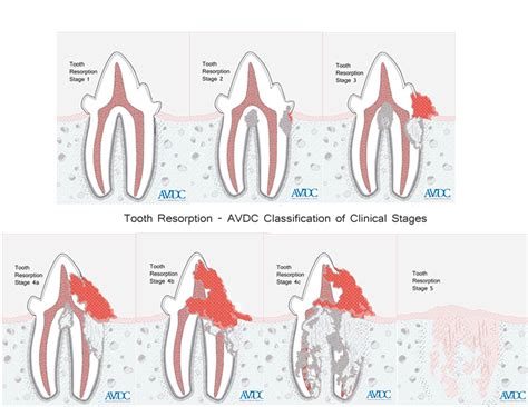 Feline Tooth Resorption What Every Cat Owner Should Know — Two Rivers