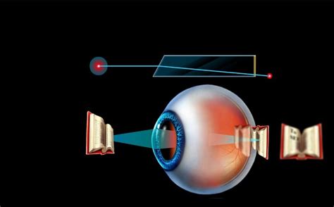 Understanding Common Vision Problems Myopia Hyperopia Astigmatism