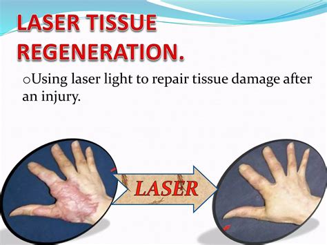 Tissue Engineering With Light Pptx