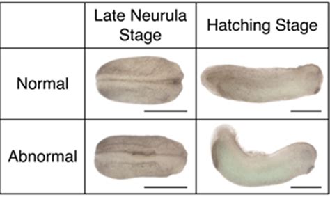 Examples Of Normal Versus Abnormal Embryos Significant Deviations From