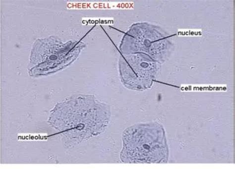 Cheek Cell 400x
