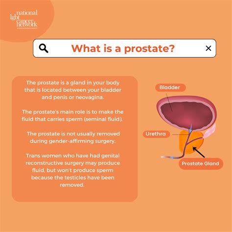 Prostate Cancer Graphics September 2022 National Lgbt Cancer Network