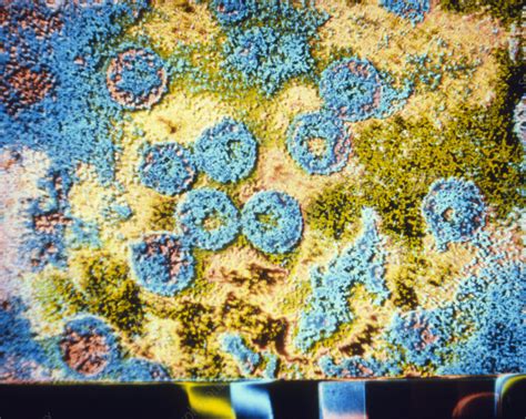 False Col Tem Of Hepatitis B Virus Particles Stock Image M0560024