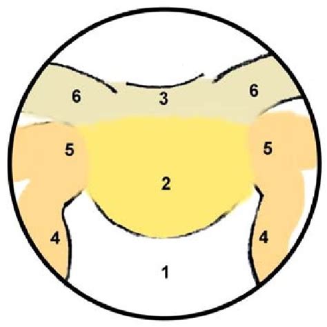 A B Ctypes Of Pneumatization Of The Sphenoid Body A Sellar Type