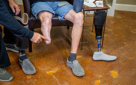 Introduction To Lower Limb Prosthetic 2022 Alltech Prosthetics