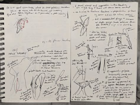 Amy Jiao — Orif Of Simple Oblique Fibular Fracture