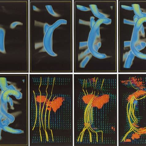 Schematics Of Three Of The Primary Vortex Interactions Which Account Download Scientific