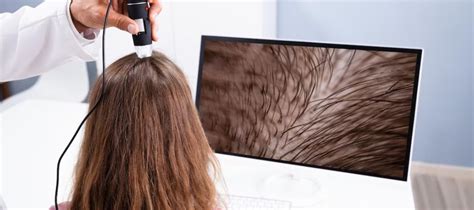 Revolutionizing Hair Loss Diagnosis With Computer Vision And Deep Learning Kritikal Solutions